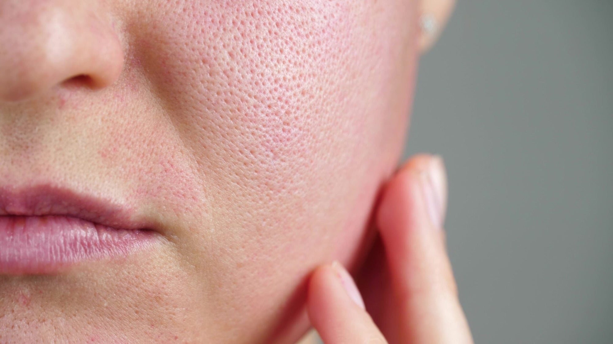 The Skin-Brain Connection: How Your Skin Microbiome Actually Affects ...